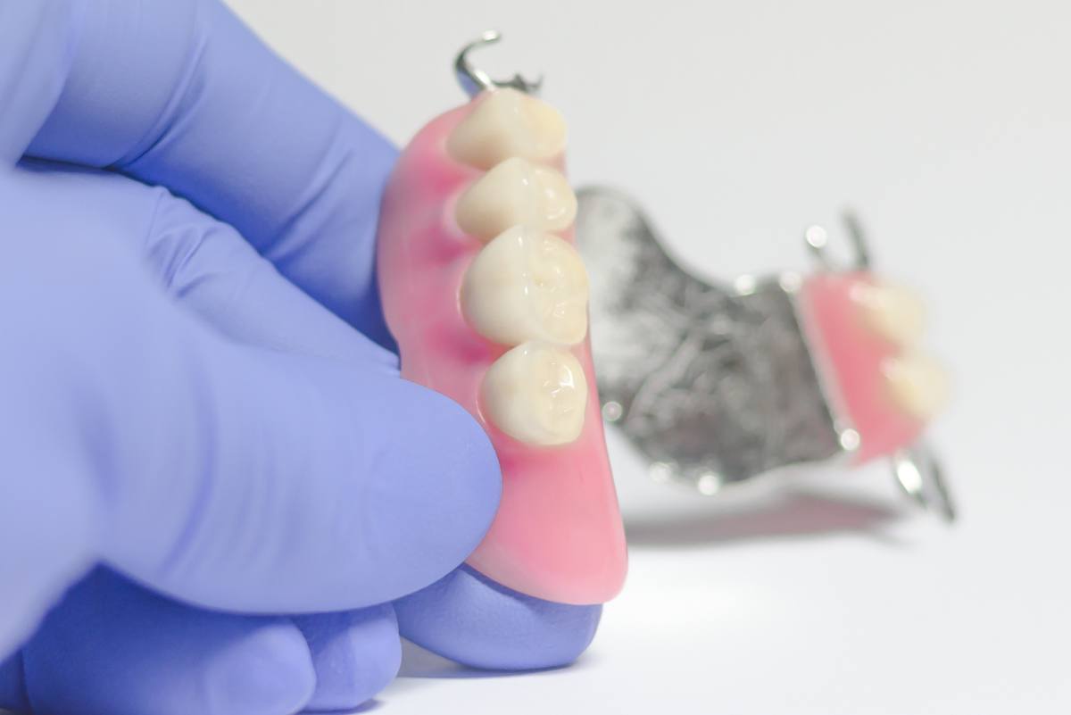 Teilprothese für die Zähne: Arten, Befestigung, Kosten